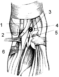 Bloqueo del nervio peroneo profundo
