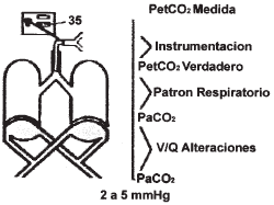 El dióxido de carbono durante la anestesia. Fisiopatología y monitoreo